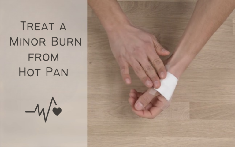 Complete Guide to Treating Burns From Hot Pans - Types, Symptoms ...